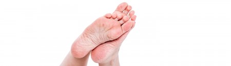 Likdoorn (eksteroog) verwijderen ? - Hanssen Footcare