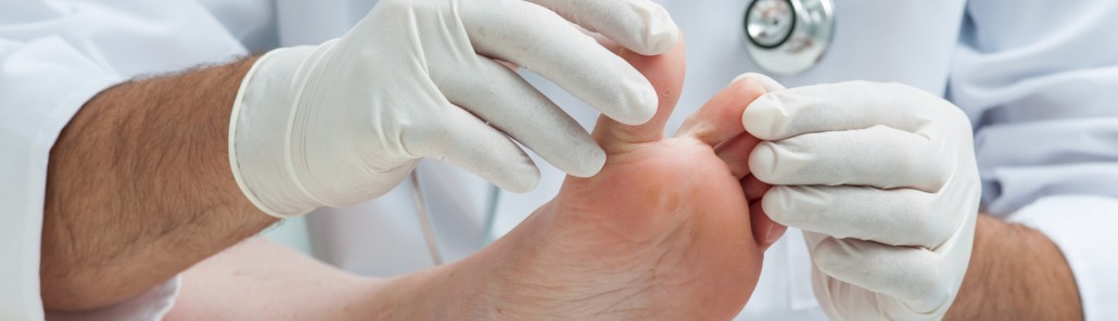 Voetschimmel - Hanssen Footcare