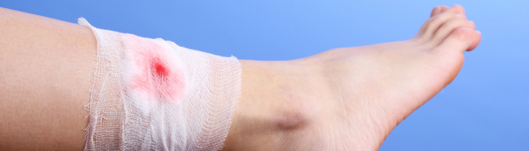 Ulcus Crusis? Verschijnselen, oorzaken & oplossingen | Hanssen Footcare